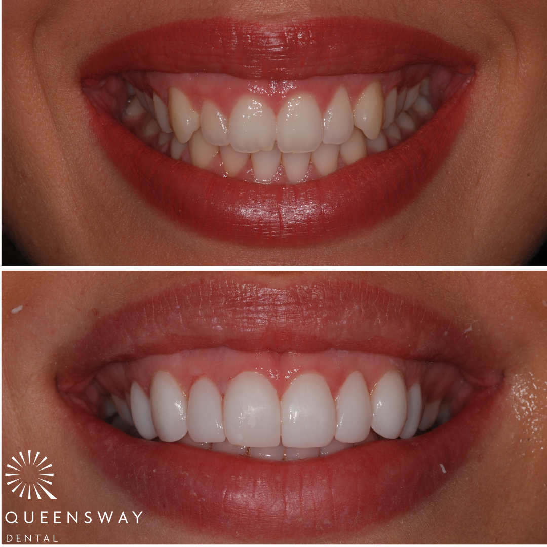 Queensway Dental Clinic | Smile update | February 2021