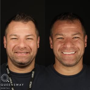 Billingham Practice | Free Parking Available | Queensway Dental Clinic